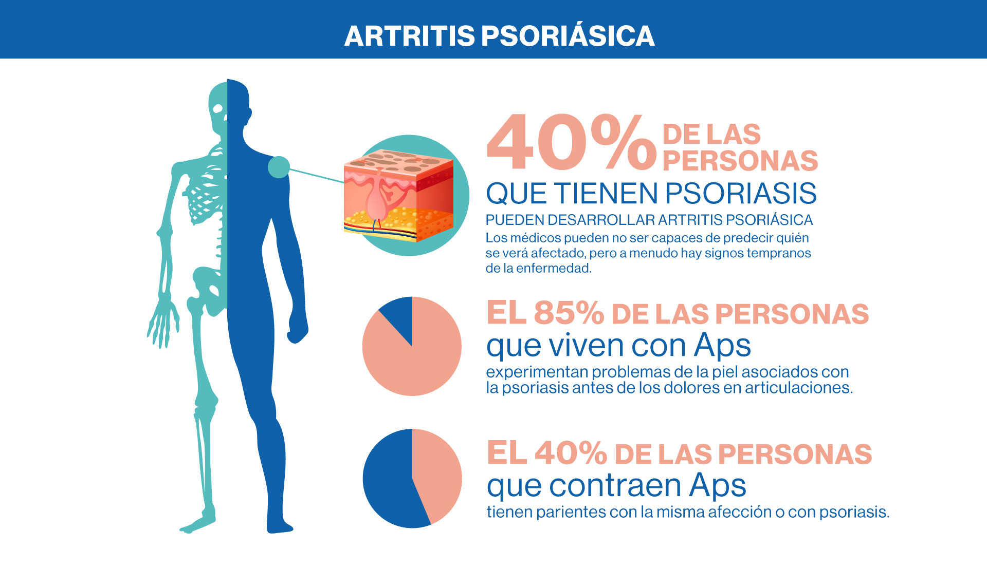Artritis psoriásica - Principal | Novartis